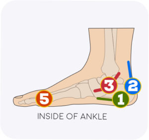 Musculoskeletal (MSK) Foot and Ankle | NHS Lanarkshire