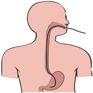 Endoscopy | NHS Lanarkshire