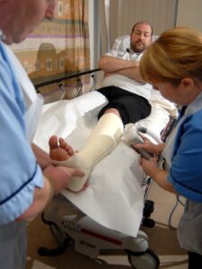 Plaster Cast | NHS Lanarkshire