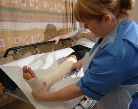 Plaster Cast | NHS Lanarkshire