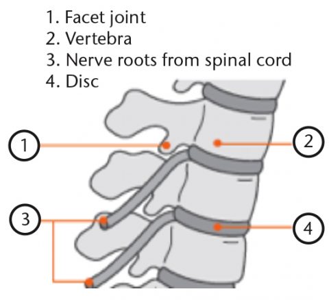 Lumbar | NHS Lanarkshire