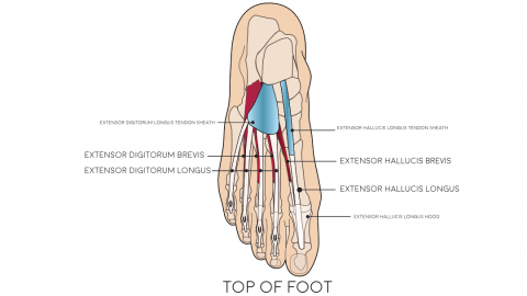 Extensor Tendinopathy | NHS Lanarkshire