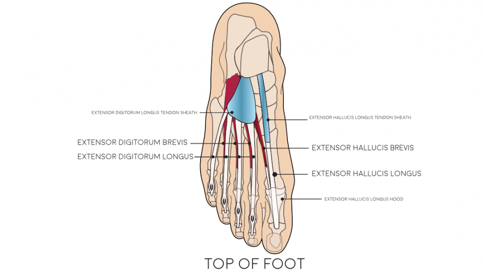 Extensor Tendinopathy | NHS Lanarkshire