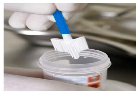 Cervical Screening | NHS Lanarkshire