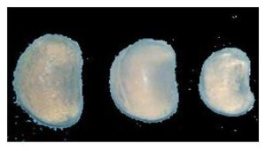 Having a ball (testicle) removed (Orchidectomy) | NHS Lanarkshire