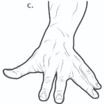 Finger Exercises | NHS Lanarkshire