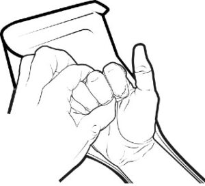 Flexor Tendon Injuries | NHS Lanarkshire