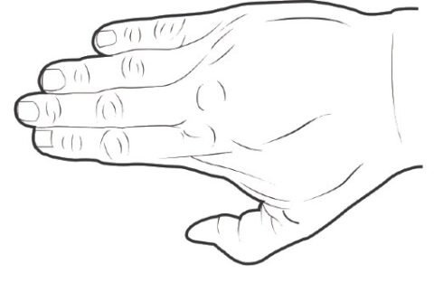 Osteoarthritis of the base of the thumb | NHS Lanarkshire