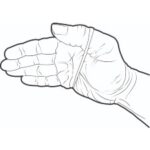 Osteoarthritis of the base of the thumb | NHS Lanarkshire