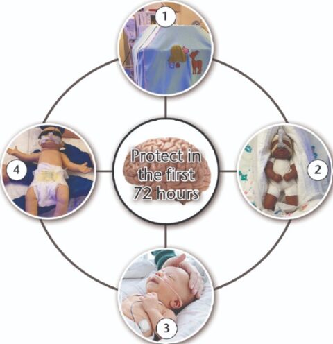 A Neuro-protection Care Guide | NHS Lanarkshire